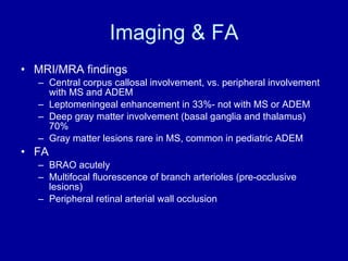 Susac Syndrome | PPT
