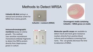 Susceptibility Update 2024 | Microbes with Morgan | PPT
