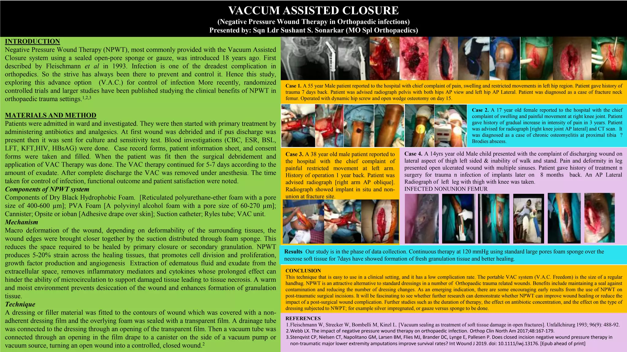 Vacuum assisted closure | PPTX