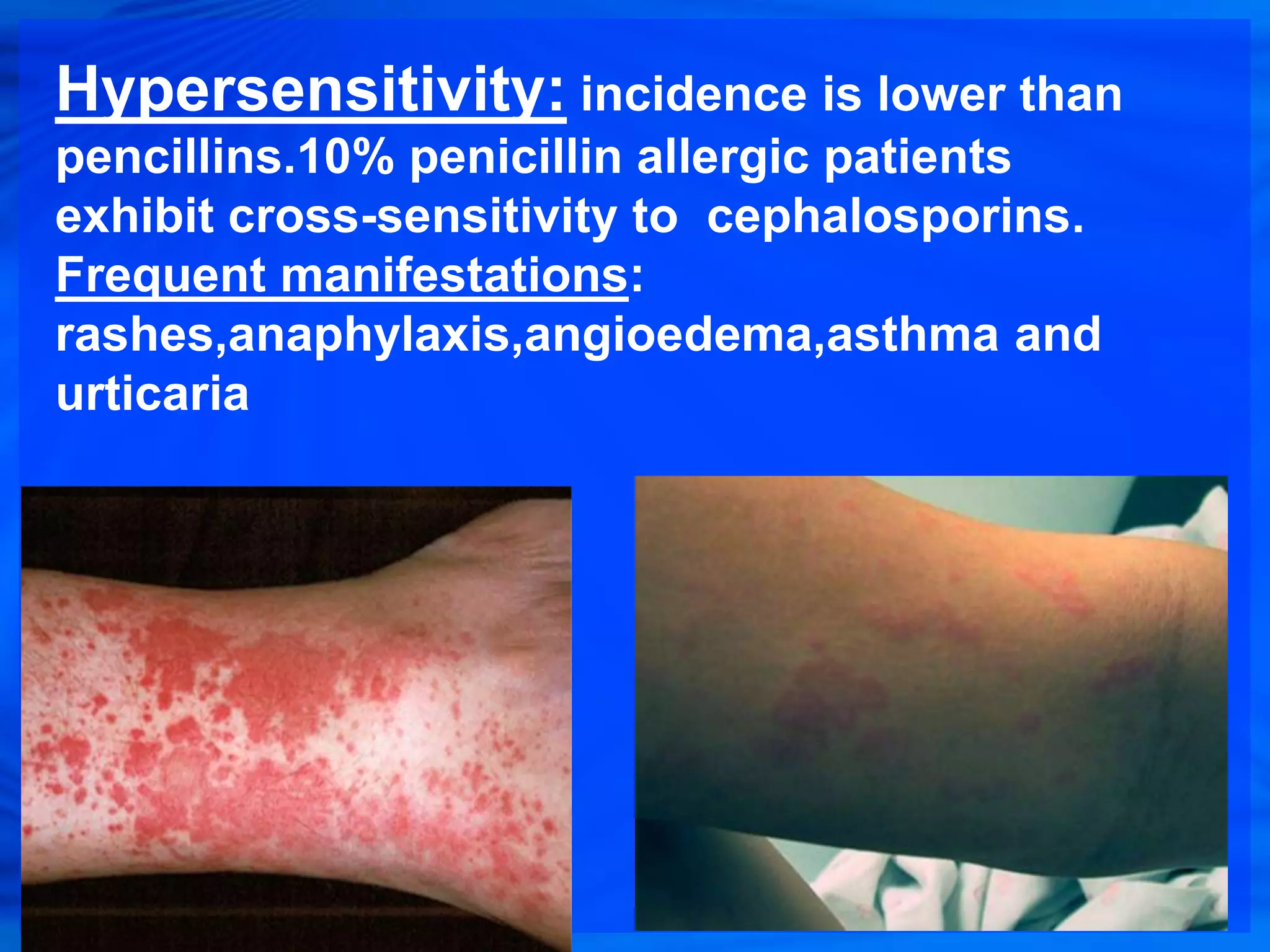 CEPHALOSPORINS | PPTX