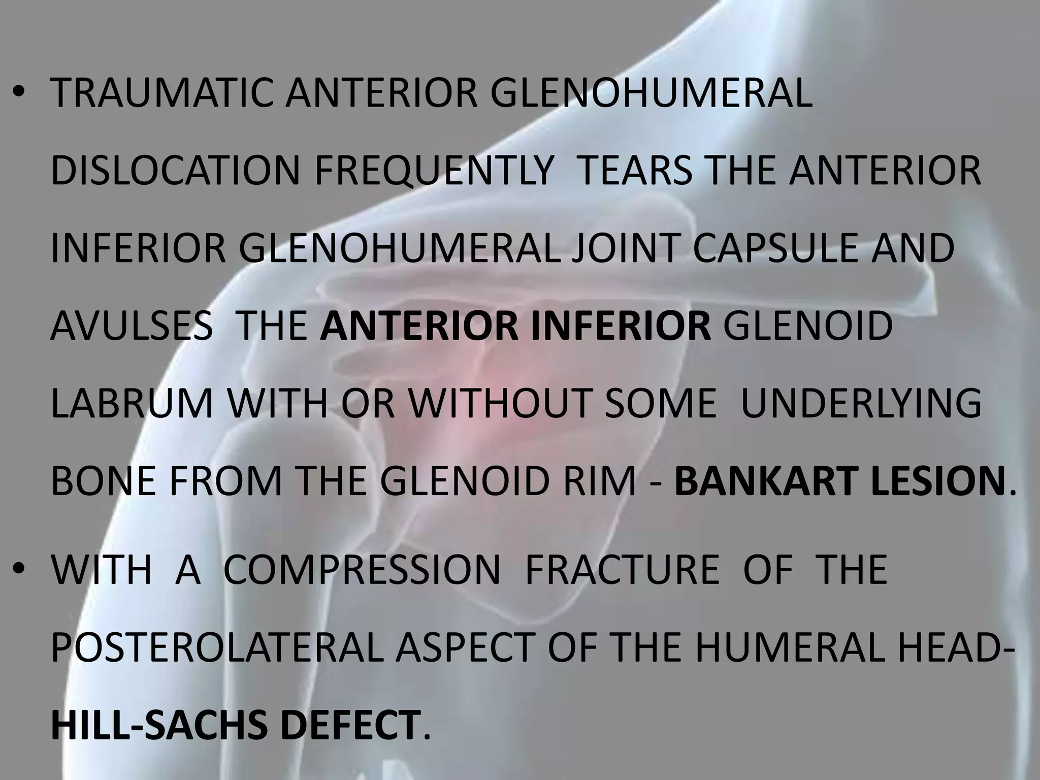 SHOULDER PATHOLOGIES IN YOUNG ACTIVE PERSONS | PPTX