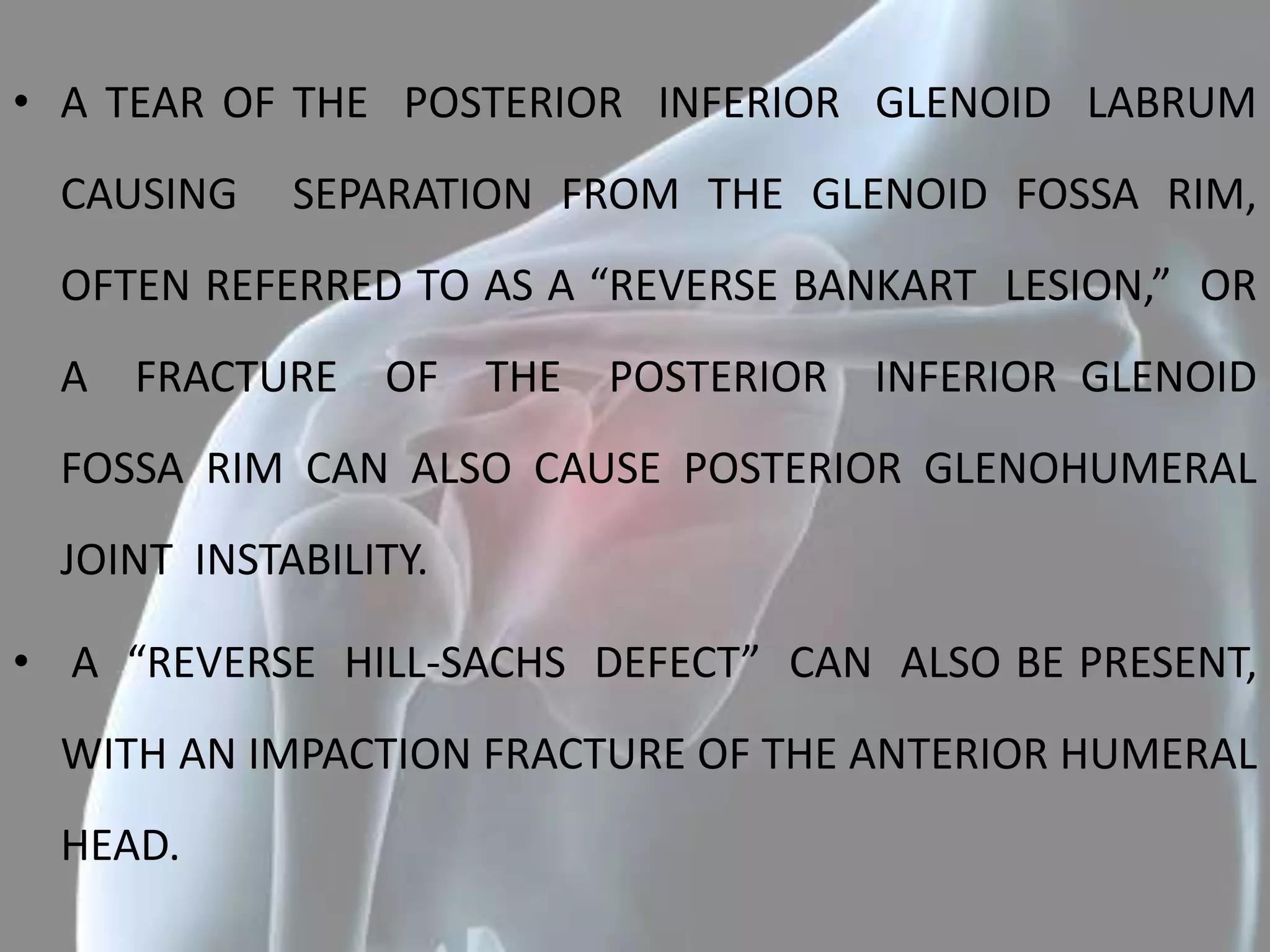 SHOULDER PATHOLOGIES IN YOUNG ACTIVE PERSONS | PPTX