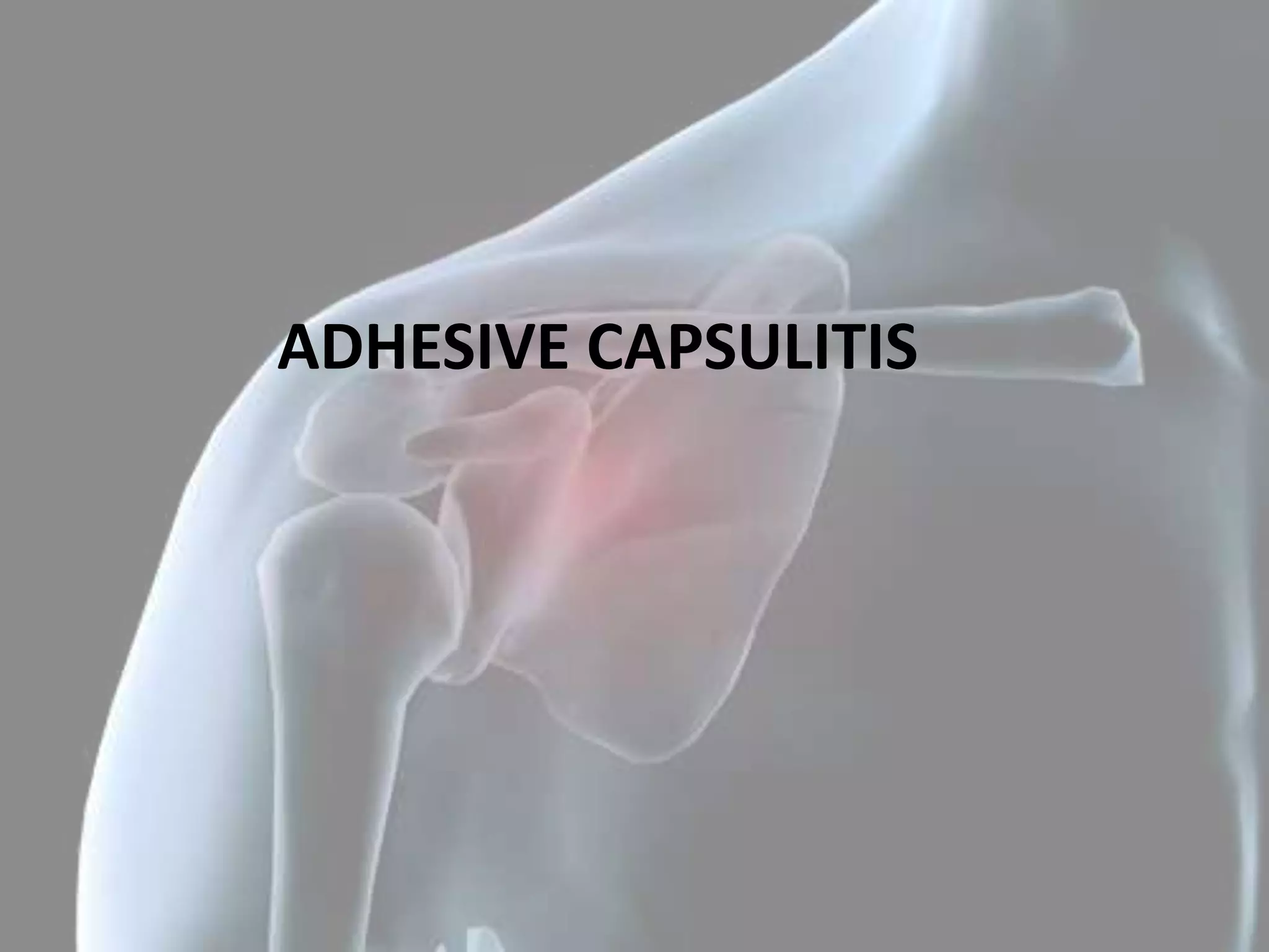 SHOULDER PATHOLOGIES IN YOUNG ACTIVE PERSONS | PPTX