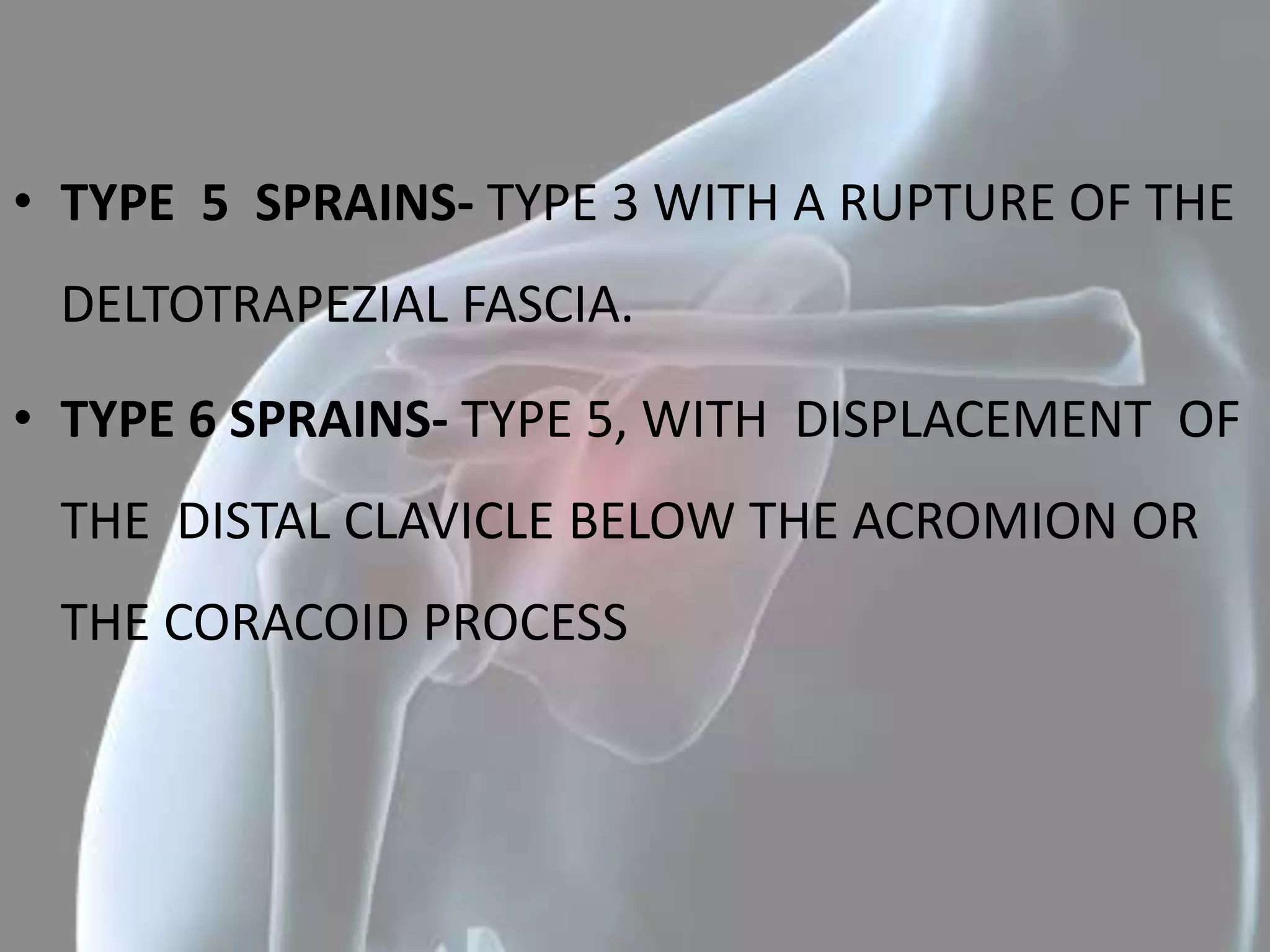 SHOULDER PATHOLOGIES IN YOUNG ACTIVE PERSONS | PPTX