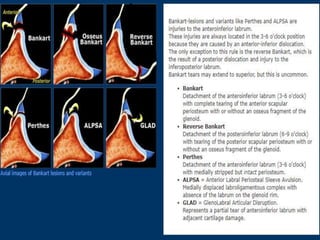 SHOULDER PATHOLOGIES IN YOUNG ACTIVE PERSONS | PPT