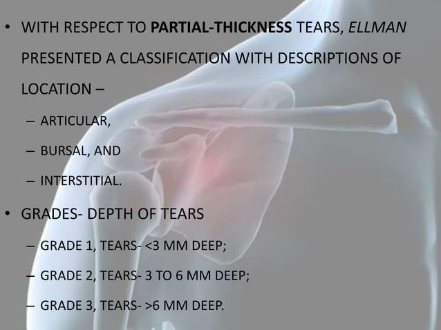 SHOULDER PATHOLOGIES IN YOUNG ACTIVE PERSONS | PPTX