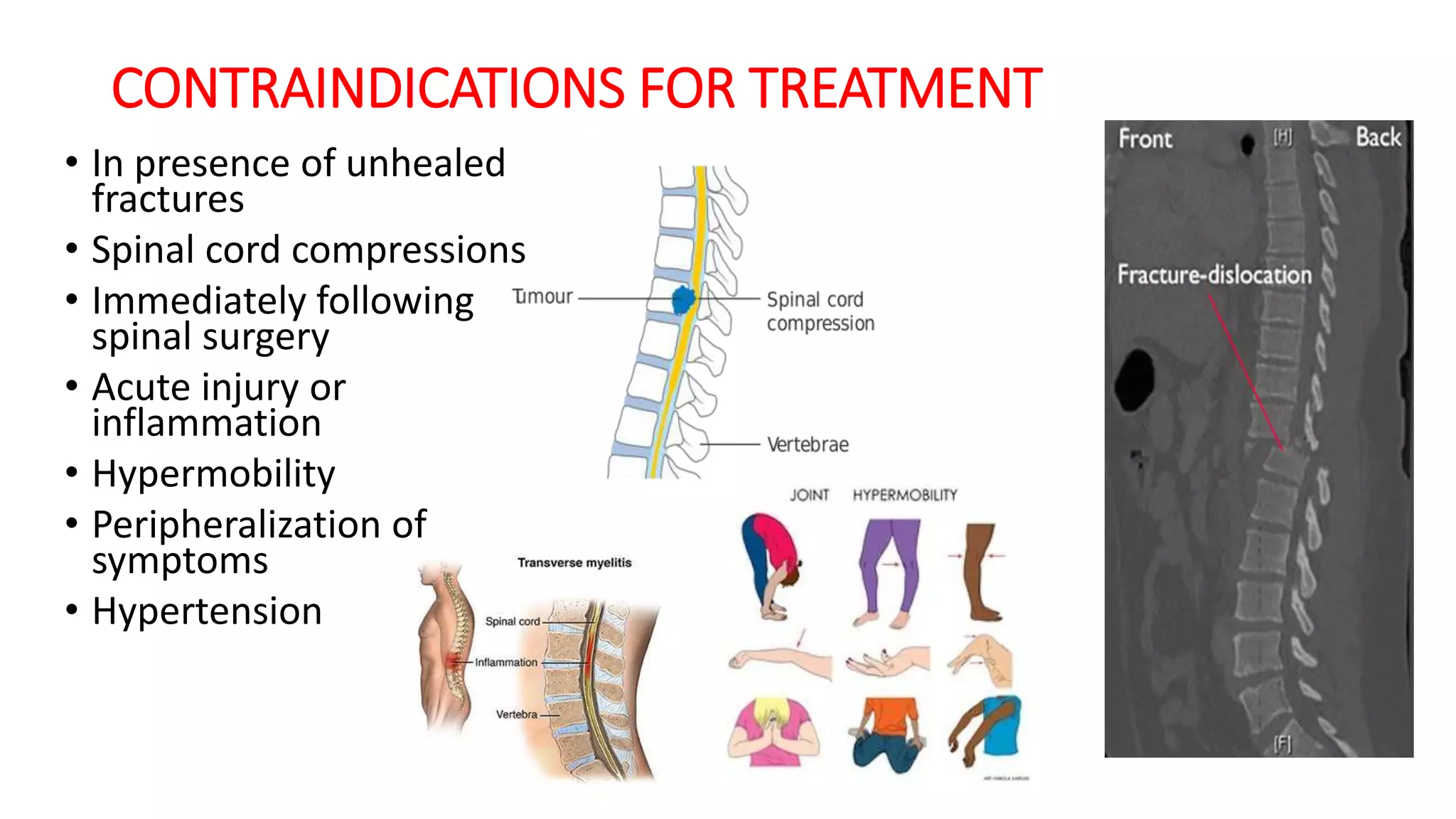 sush kiru manual therapy.pptx