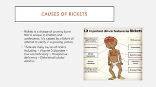 sush pediatrics vitamin d.pptx