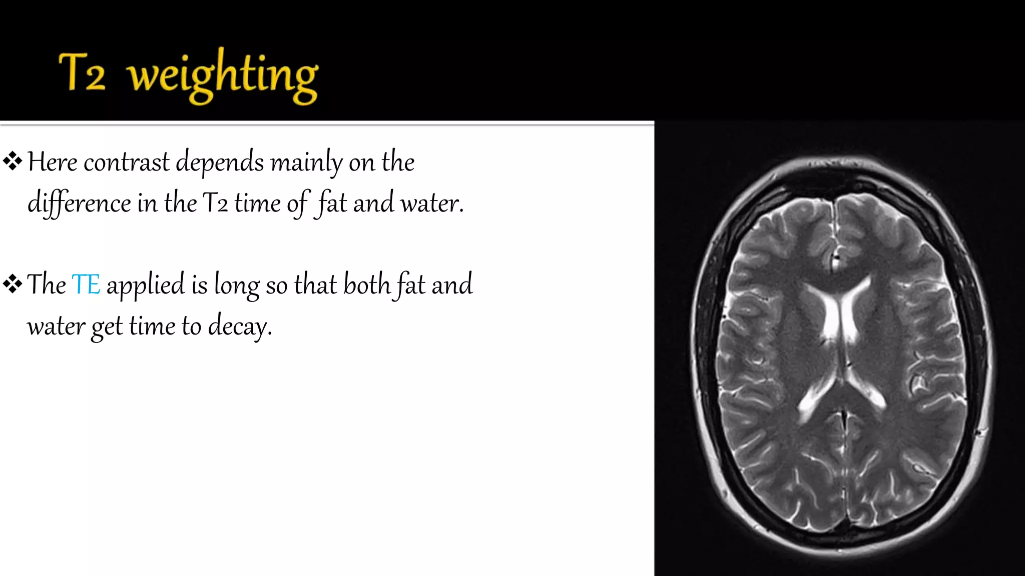 MRI PRINCIPLES, WEIGHTING AND CONTRAST | PPTX
