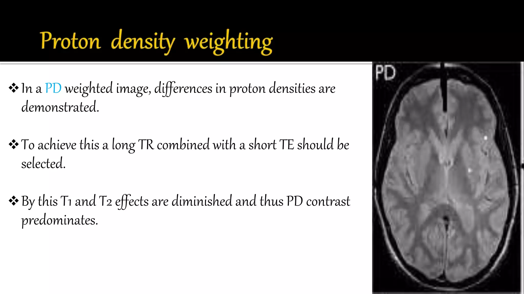 MRI PRINCIPLES, WEIGHTING AND CONTRAST | PPTX