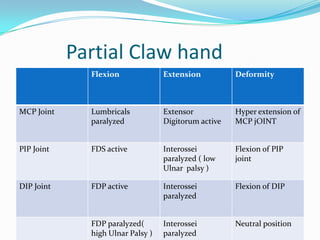 Susil seminar claw hand | PPTX