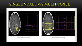 MR Spectroscopy | PPTX