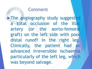 Suspected Aortofemoral Bypass Graft Thrombosis.pdf