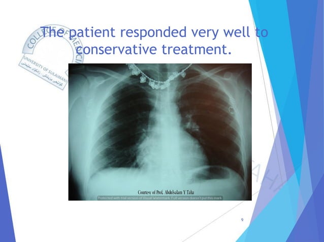 Suspected Right Lower Lobe Bronchiectasis.pdf