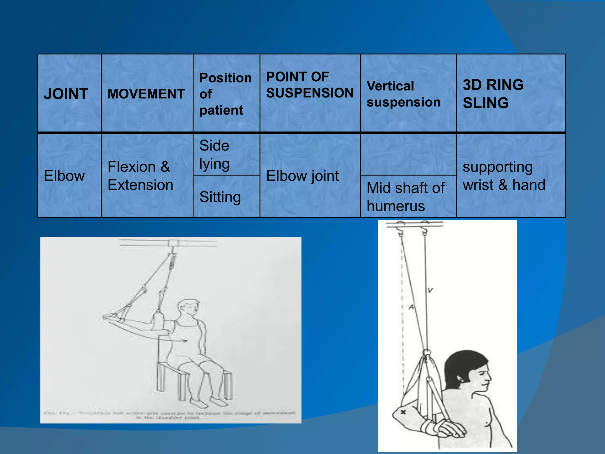 Suspension Therapy | PPT
