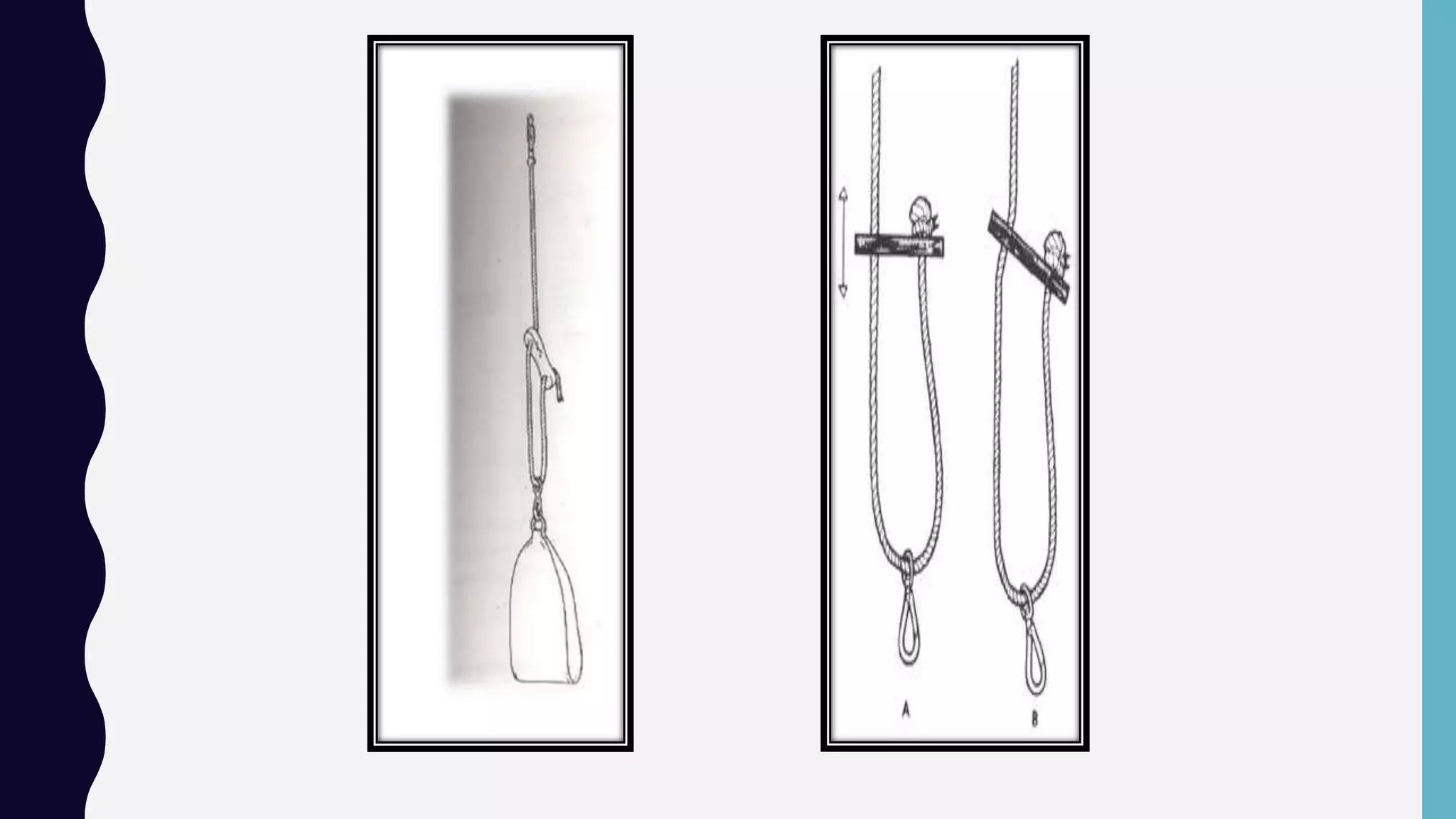 Suspension therapy | PPTX