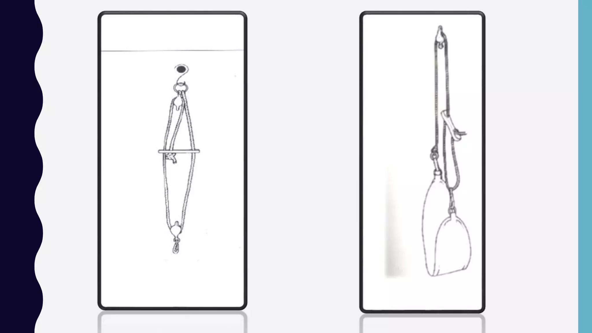 Suspension therapy | PPTX
