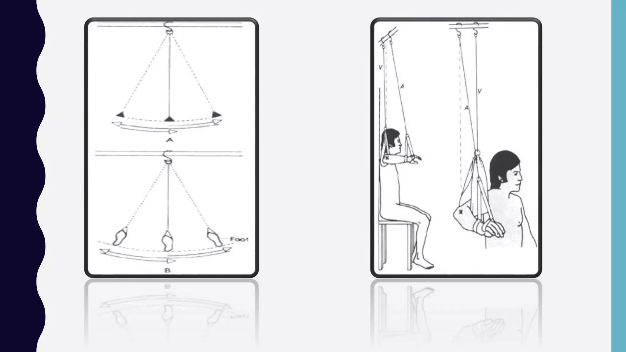 Suspension therapy | PPTX