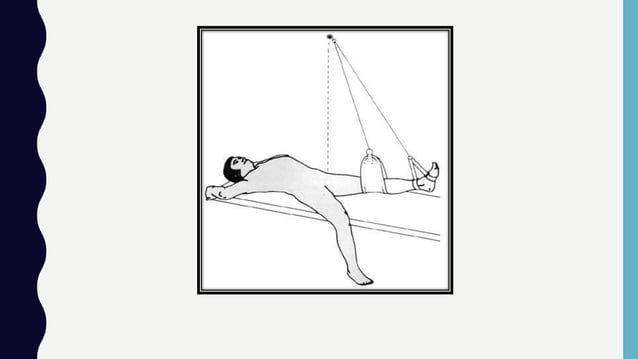 Suspension therapy | PPTX | Physical Therapy | Wellness