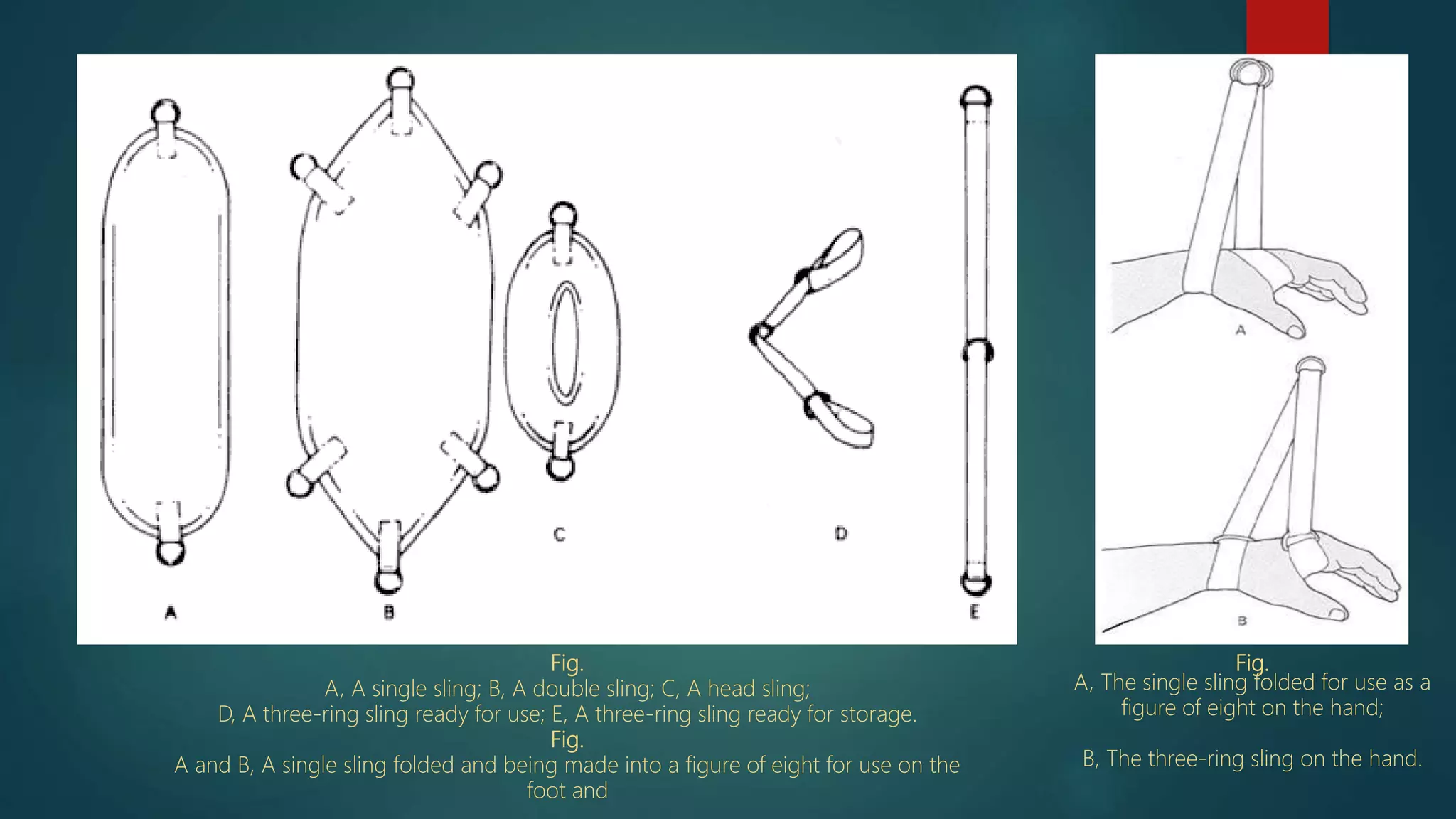 SUSPENSION THERAPY | PPTX