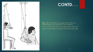 SUSPENSION THERAPY | PPTX