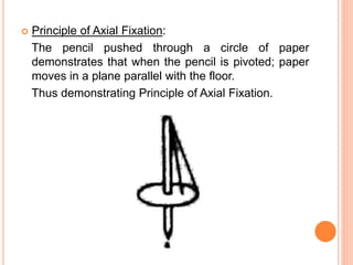 SUSPENSION THERAPY.pptx