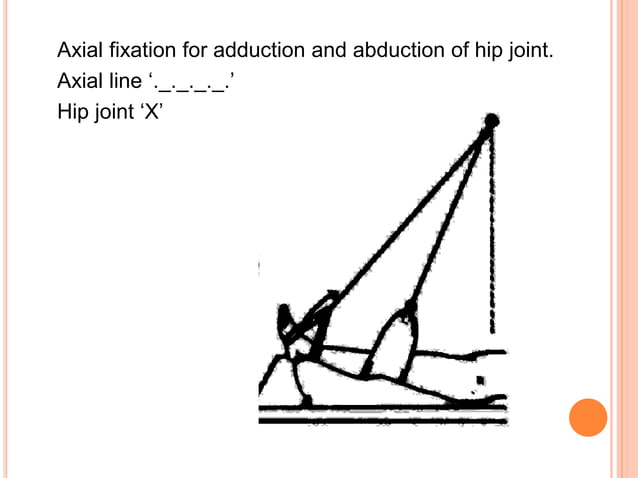 SUSPENSION THERAPY.pptx