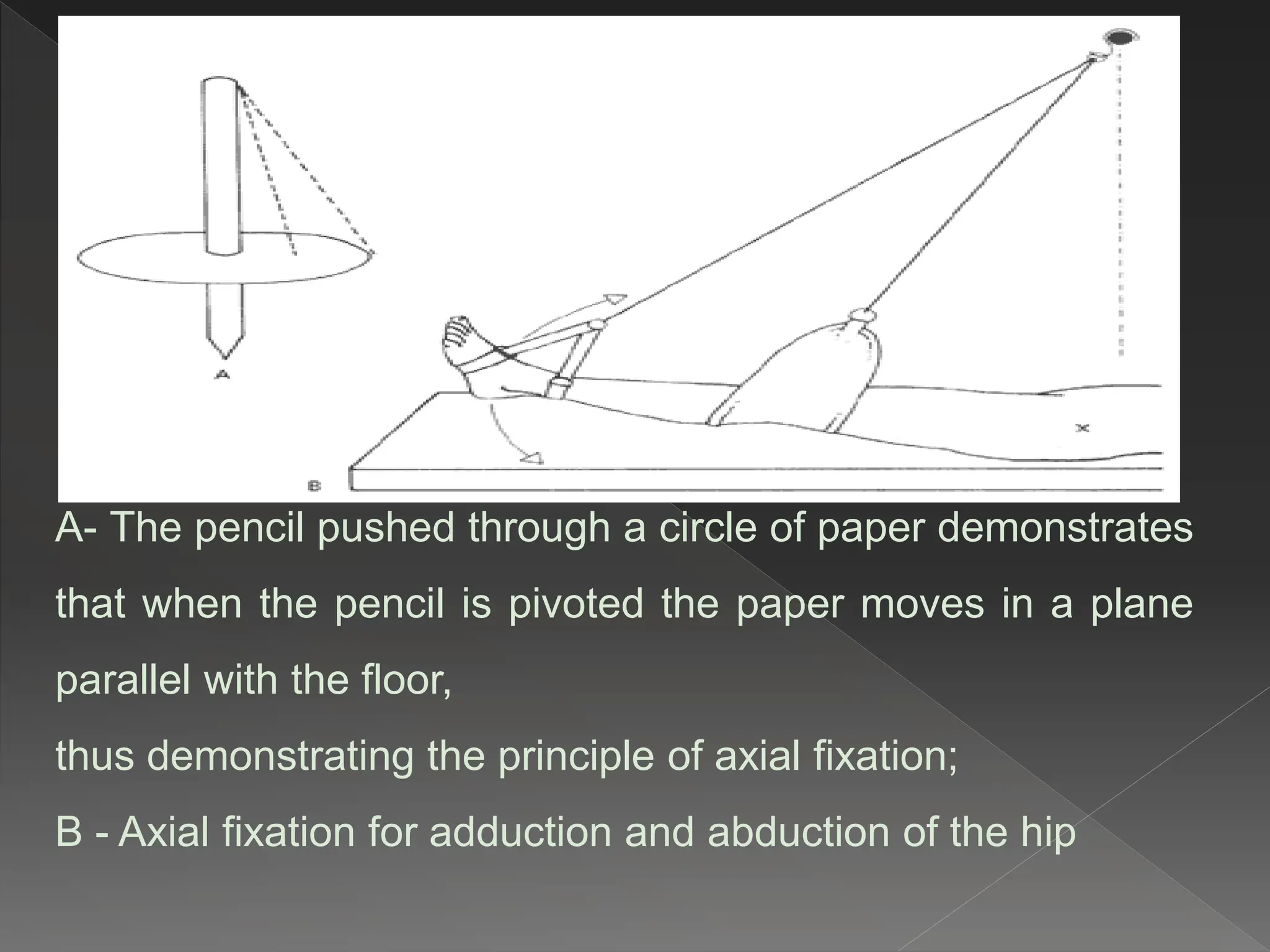 Suspension therapy_111333.pptx physiotherapy | PPTX