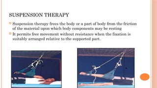 suspension therapy by dr.elansooriyan mpt pediatrics | PPTX