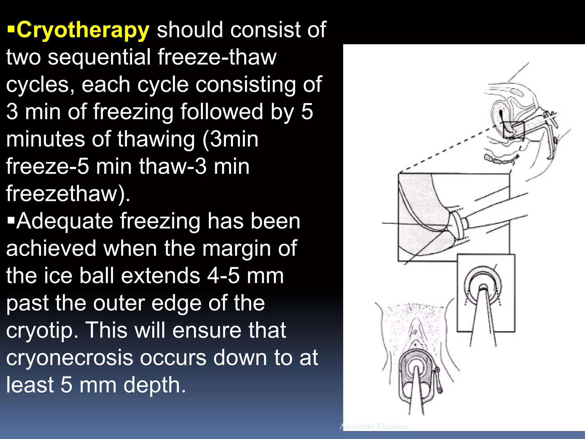 Clinically Suspicious cervix | PDF