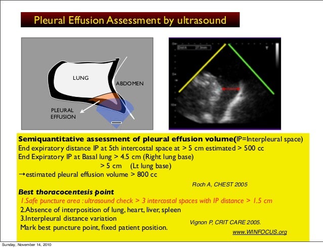 Airway and Breathing ultrasound