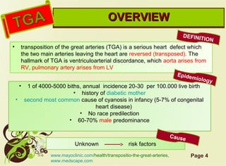 Sutton 7 transposition of the great arteries | PPT