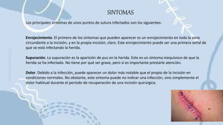 Sutura.pptx