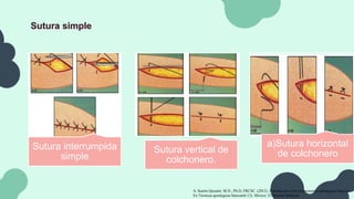 Sutura, hilo y sus tipos.pptx