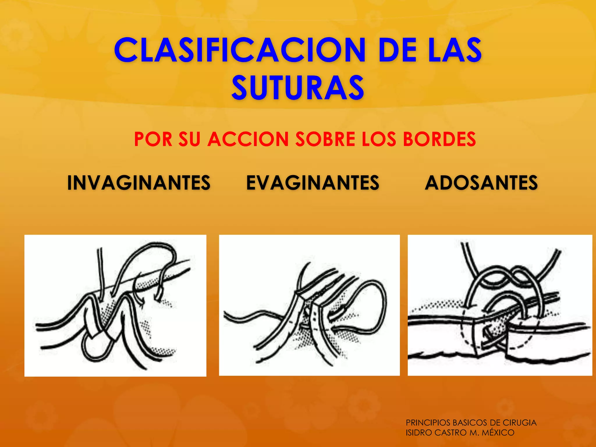 Suturas | PPTX | Surgery | Medical Health