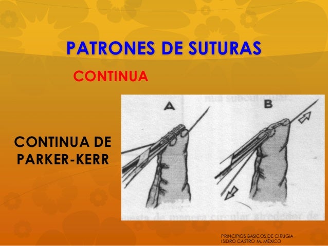 Suturas en odontologia