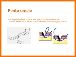 SUTURAS CLASE 1 (1).pptx