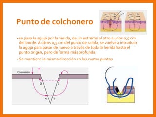 SUTURAS CLASE 1 (1).pptx