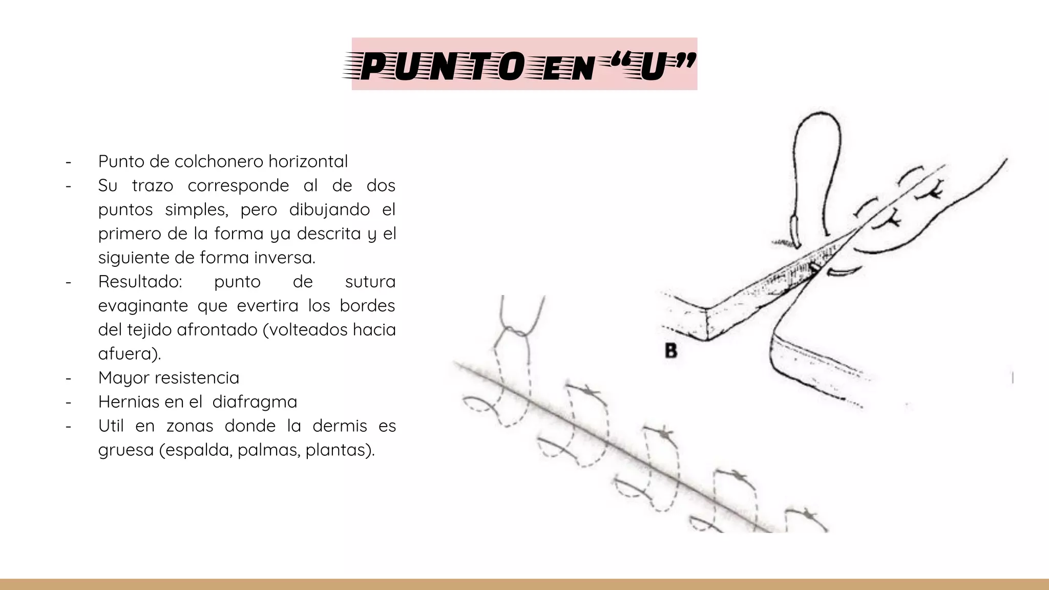Suturas, Nudos, Ligaduras y Puntos de Sutura (1).pdf