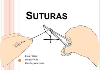 Suturas | PPTX | Surgery | Medical Health