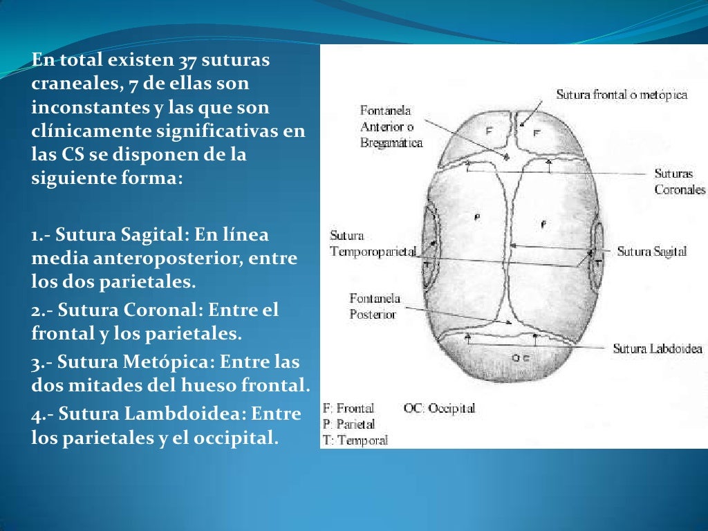 Suturas y fontanelas