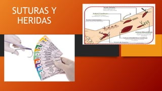 tecnica quirurgica suturas y heridas 2.pptx