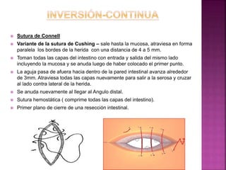 SUTURAS, TECNICAS DE SUTURAS Y NUDOS OJO | PPTX