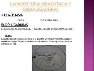 SUTURAS, TECNICAS DE SUTURAS Y NUDOS OJO | PPTX