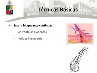 Tipos de Suturas | Tipos de suturas, Enfermería quirúrgica, Quirúrgica - brentwooddental.com
