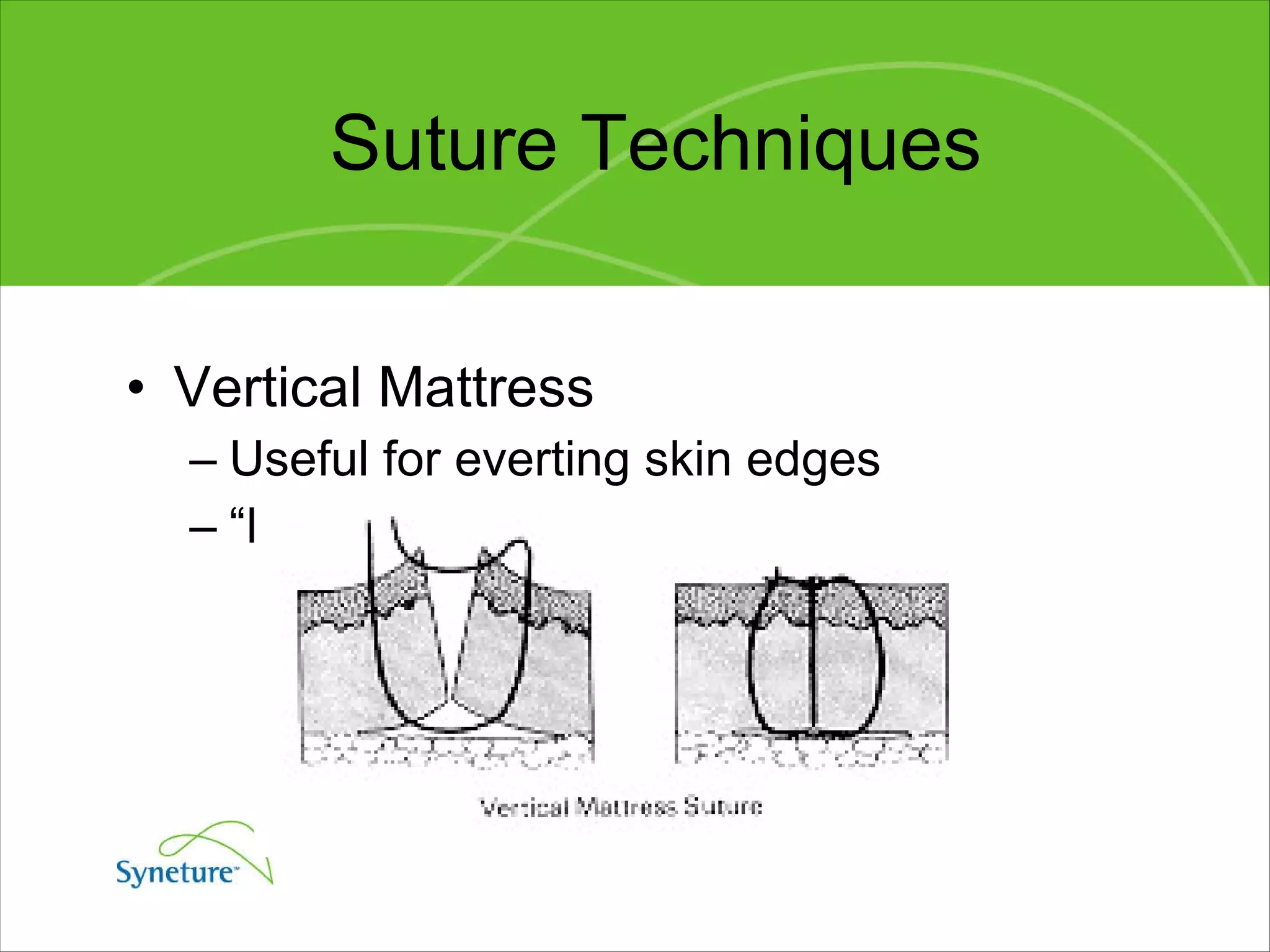 Suture | PPT