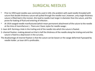 Suture in ophthalmic surgery | PPT