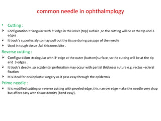 Suture in ophthalmic surgery | PPT
