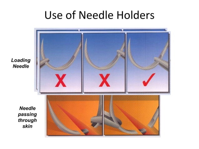 Suture in ophthalmic surgery | PPT