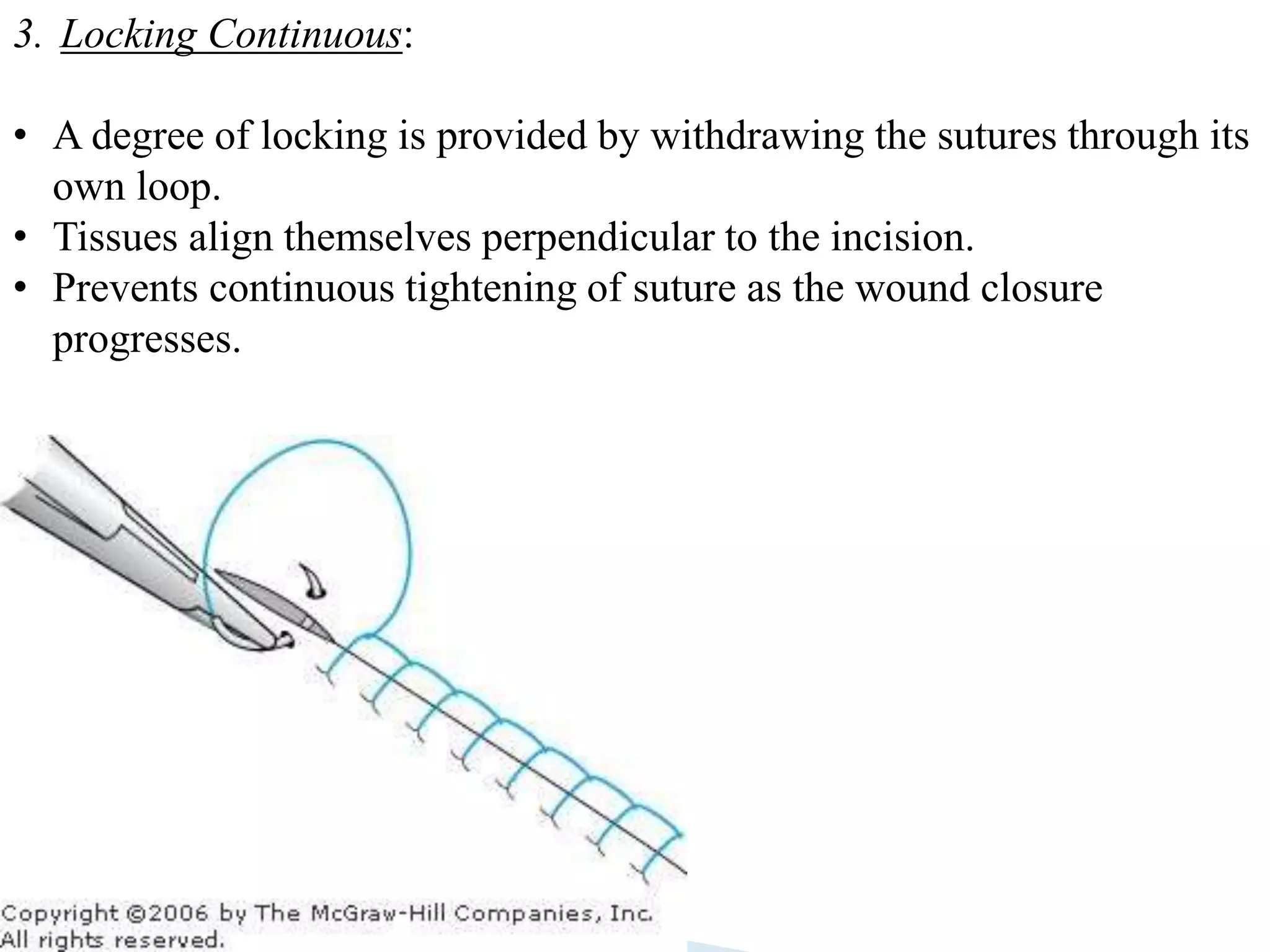 Suturing Materials and Techniques | PPTX